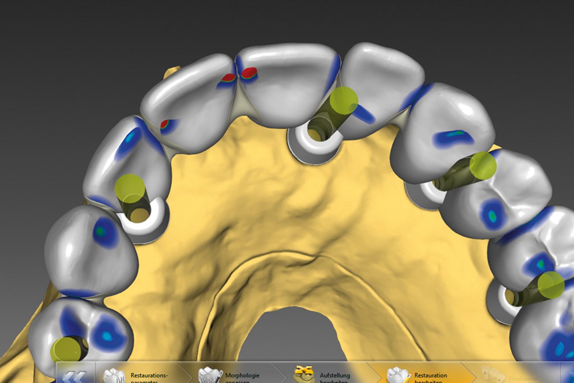 Dental Services - Confident Dental Lab Minnesota